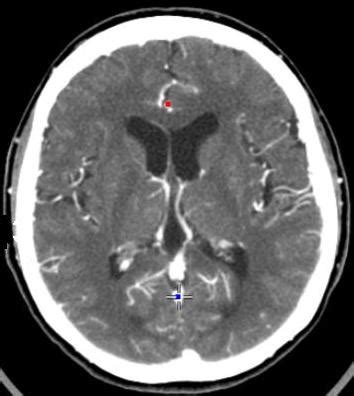 Brain Waves And Other Brain Measures How Do You Think