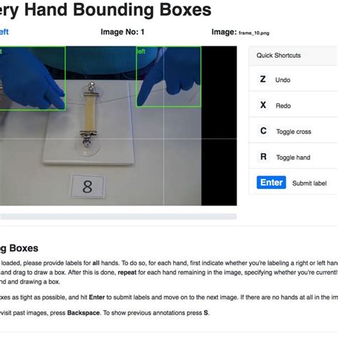 Surgery Detection Performance Across Annotated Hand Datasets Although