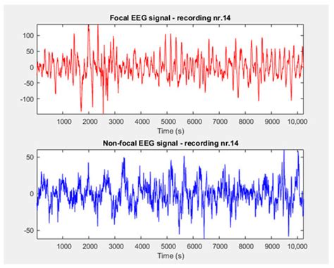 A Novel Automated Empirical Mode Decomposition Emd Based Method And Spectral Feature