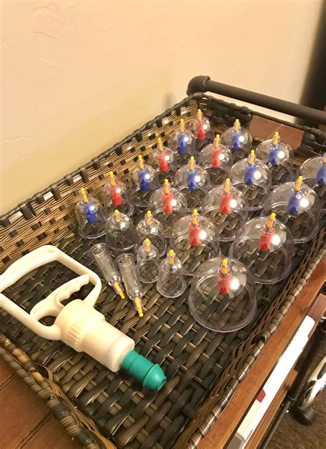 Myofascial Decompression Cupping Myofascial Chiropractic