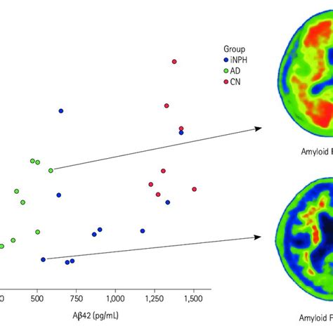 Correlation Between Aβ42 And Aβ40 Levels In Inph Ad And Cn Subjects