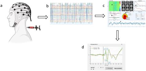 A Randomized Controlled Trial Comparing Different Sites Of High Velocity Low Amplitude Thrust On