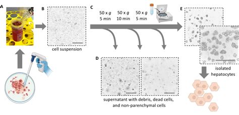 Isolation Of Regenerating Hepatocytes After Partial Hepatectomy In Mice