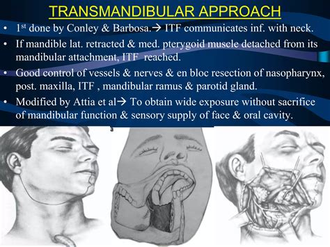 Surgical Anatomy Of Infratemporal Fossa By Dr Aditya Tiwari Pptx