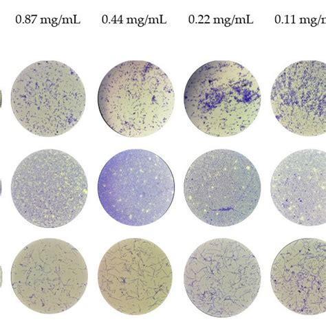 Micrographs Of Candida Spp Cells Treated With Various Concentrations