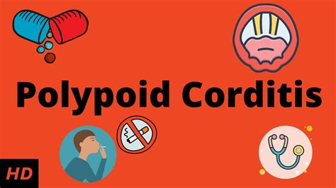 Polypoid Corditis Smokers Polyp Causes Signs And Symptoms