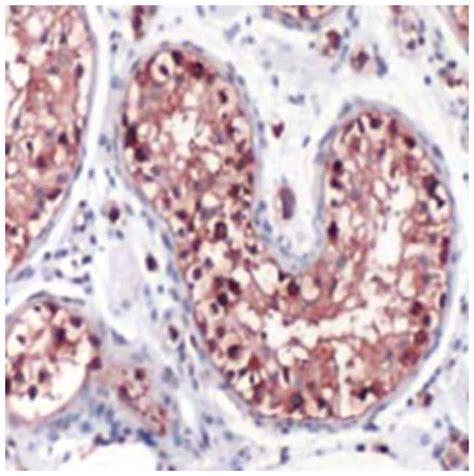 Anti Gclc Antibody 100ul