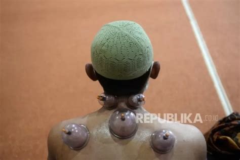 Manfaat Terapi Bekam Di Berbagai Titik Tubuh Magenta