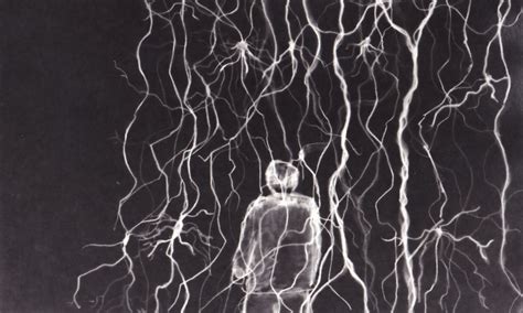 White Out Review In Lancet Neurology White Out