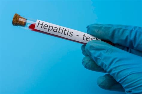 Seite 2 | Hbv Bilder - Kostenloser Download auf Freepik