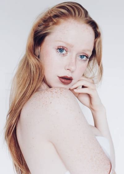 Post [713197768051654656] Beaucoup Freckles Tumbex
