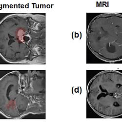 Sample Segmentation Outputs For D U Net Segmentation