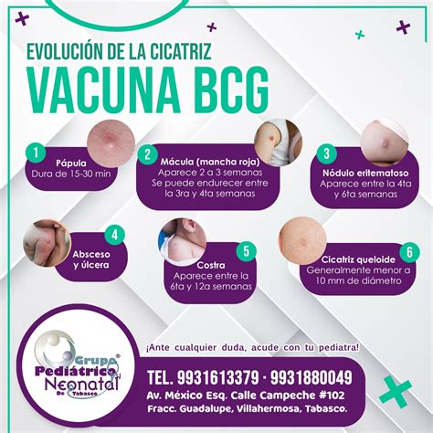La Vacuna Bcg Grupo Pediátrico Y Neonatal De Tabasco