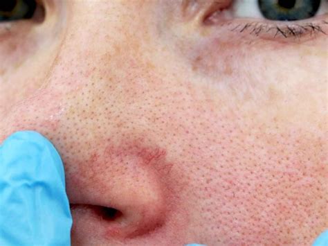 Skin Rashes Is A Trouble Causes And Solutions Taiz Mind