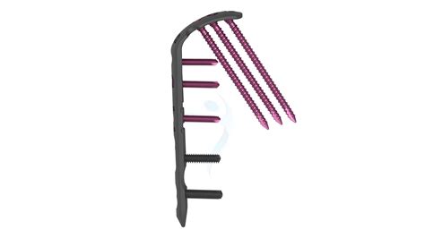 2 7 3 5 Proximal Olecranon Plate Valp