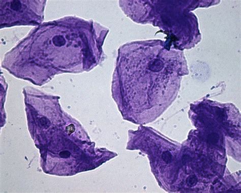 Medical School • Human Cheek Cells As Seen In An Electron