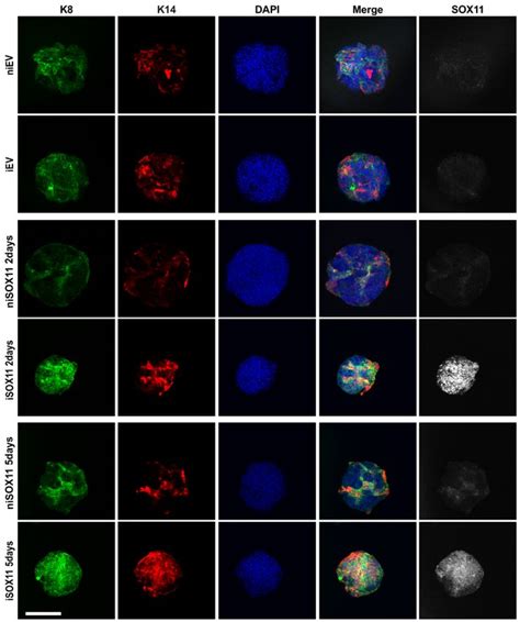 Figures And Data In SOX11 Promotes Epithelial Mesenchymal Hybrid State