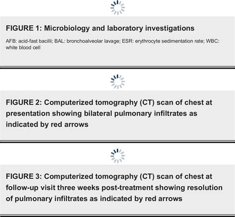 Figure 2 From Daptomycin Induced Acute Eosinophilic Pneumonia Semantic Scholar