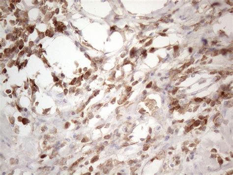 Anti SFRP2 Antibody Mouse Anti Human Monoclonal IHC WB LSBio