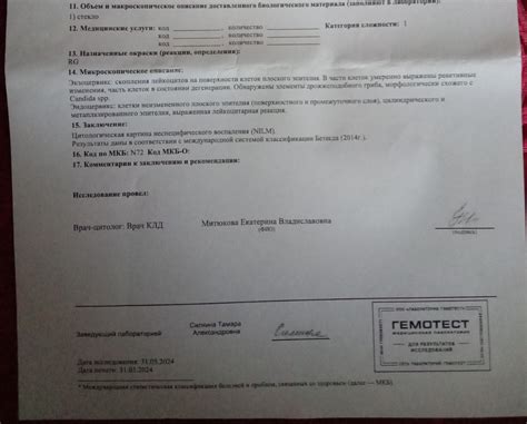 Вагинальный кандидоз Вопрос гинекологу 03 Онлайн