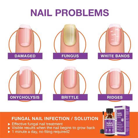 Pureskin Fungal Nail Renewal Maximum Strength Treatment For Nail
