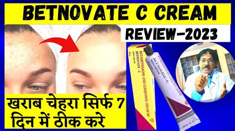 Betnovate C Skin Cream Use Side Effects Betnovate C Cream Review Pharmacist Kunduji