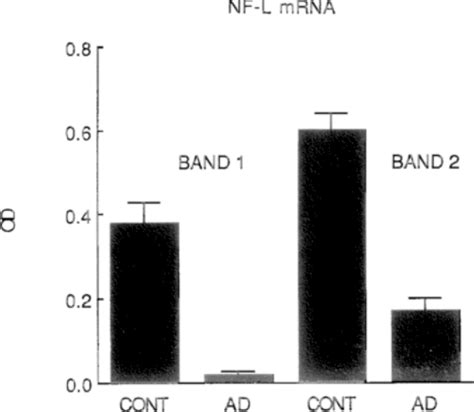 Figure 2 From Cytoskeletal Neurofilament Gene Expression In Brain