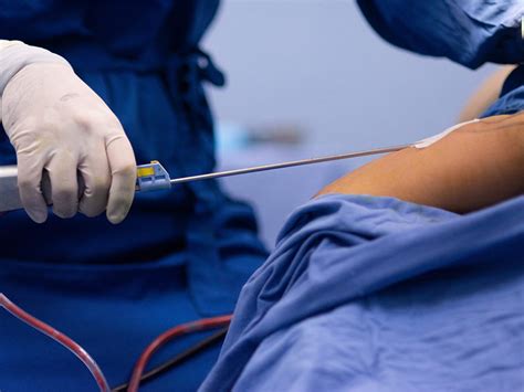 Body Contouring Toronto On Demand Plastic Surgery