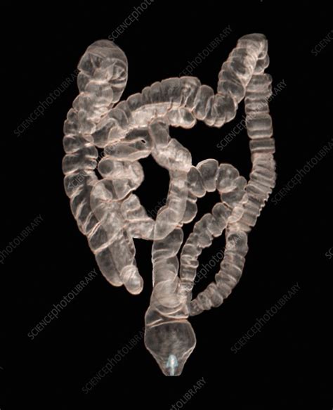 Normal Intestines 3d Ct Scan Stock Image F003 9164 Science Photo