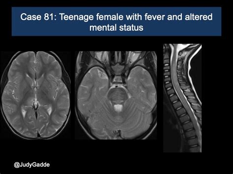 Spine Cases — Neuroradiologyu