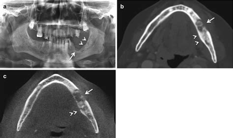 Imaging Modalities And Characteristics In Medication Related