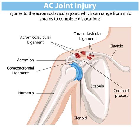 Best Shoulder Specialist In Mumbai Sports Ortho