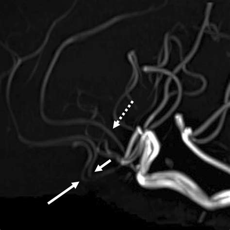 Schematic Illustration Of Five Types Of Persistent Primitive Olfactory Download Scientific