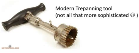 71 Brain Dysfunction Flashcards Quizlet