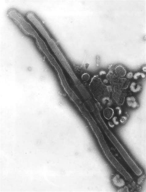 Transmission Electron Microscope Micrograph