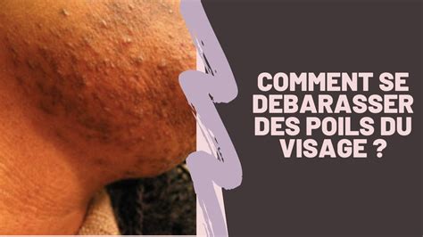 COMMENT SE DEBARASSER DES POILS DU VISAGE POIL INCARNE FEMME AVEC