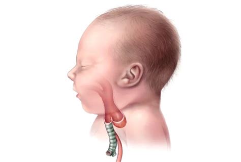 Apamedic
