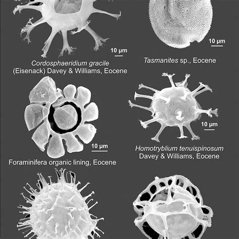 Dinocysts Chlorophyta Algae And Foraminifera Organic Lining From