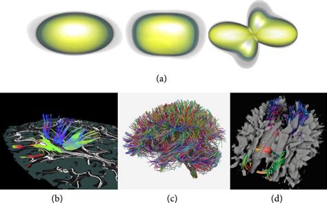 Visualizations Of Diffusion Tensor Medical Images With A Glyphs 63