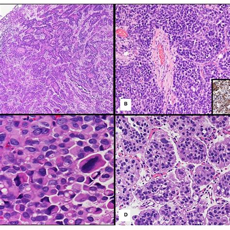 A Serial Dissected Bladder Transversely From The Bladder Neck To