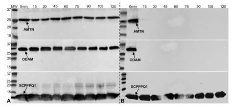 1 Western Blot Analysis Following In Vitro Exposure Of Amtn Odam And