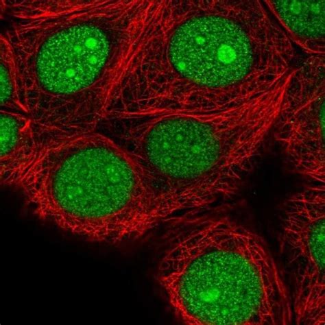 Invitrogen Spc24 Polyclonal Antibody 100 μl Unconjugatedantikroppar