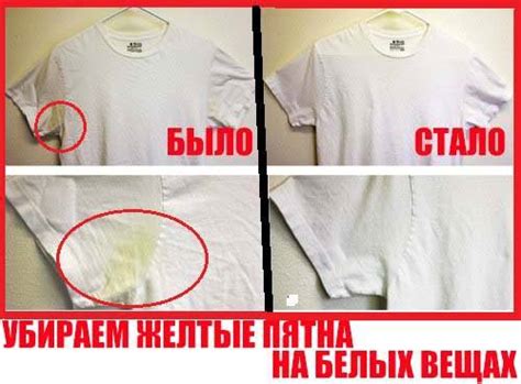 Как отстирать белые футболки от желтых пятен пота под мышками: список ...