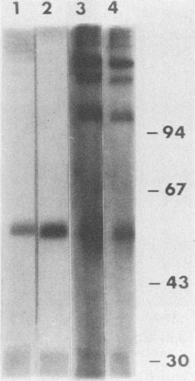 Generation Of Hydrophilic Forms Of The 58 Kda Monomer And Oligomer L