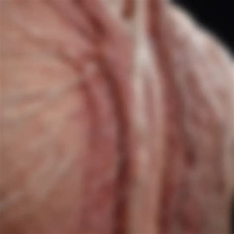 A Comprehensive Examination Of Periarteritis Nodosa