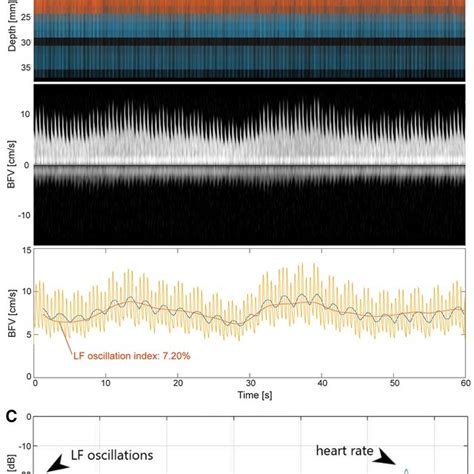The Relationship Between Arterial Low Frequency Oscillations And