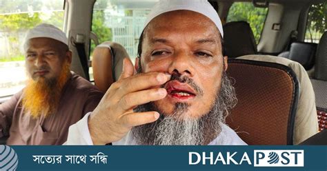 চরমোনাই পীরের ওপর হামলার নিন্দা রওশন এরশাদের