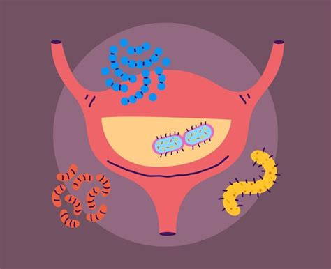 Premium Vector Human Bladder With Bacteria And Germs