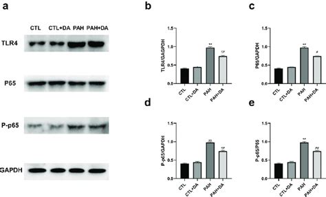Effects Of Dapagliflozin On The Expression Of Tlr4p65 Signal Pathway