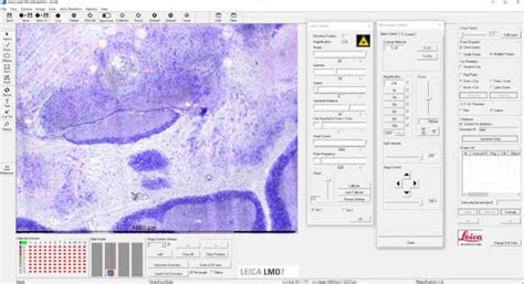 Leica Lmd6 And Lmd7 Laser Microdissection Microscopes